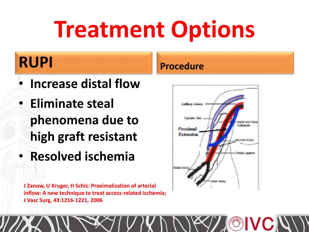 PPT - M Mazen Hachem *, MD, PhD, FACS., M Bosaeed * and M Wakka ...