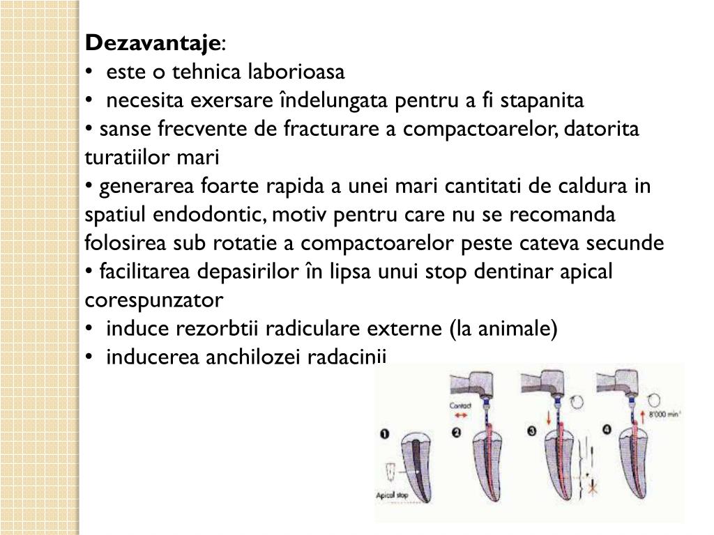 PPT - Tehnici s i materiale de obtura t i e a canalelor radiculare ...