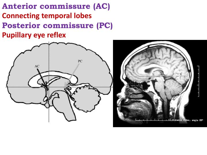 PPT - DIENCEPHALON PowerPoint Presentation - ID:1921378
