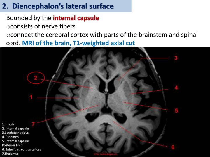 PPT - DIENCEPHALON PowerPoint Presentation - ID:1921378