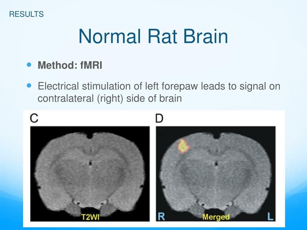 PPT - Suzuki, Sasaki, Kocsis , Honmou , et. al. Sapporo Medical ...