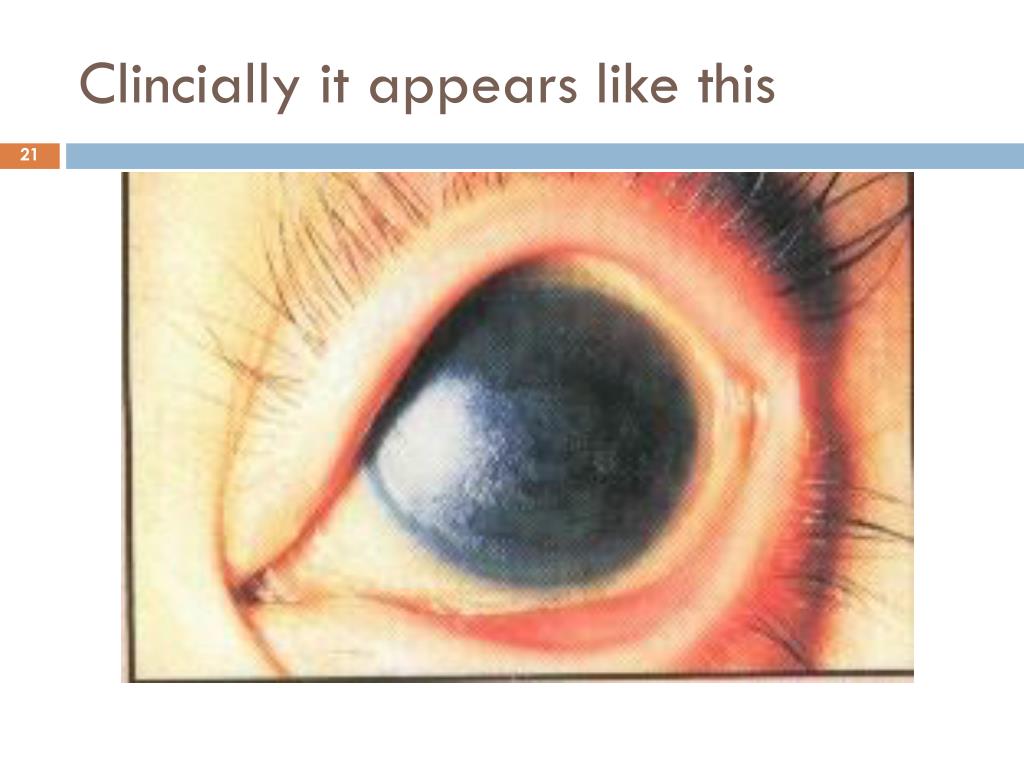 PPT - Review of clinical anatomy and physiology of the conjunctiva ...
