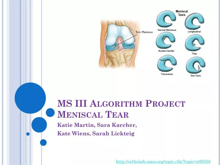 PPT - MS III Algorithm Project Meniscal Tear PowerPoint Presentation ...