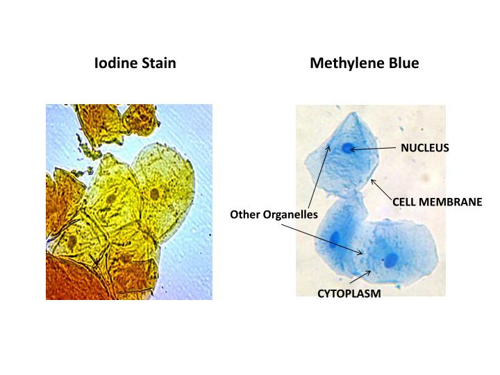 PPT - Iodine Stain PowerPoint Presentation - ID:1922886