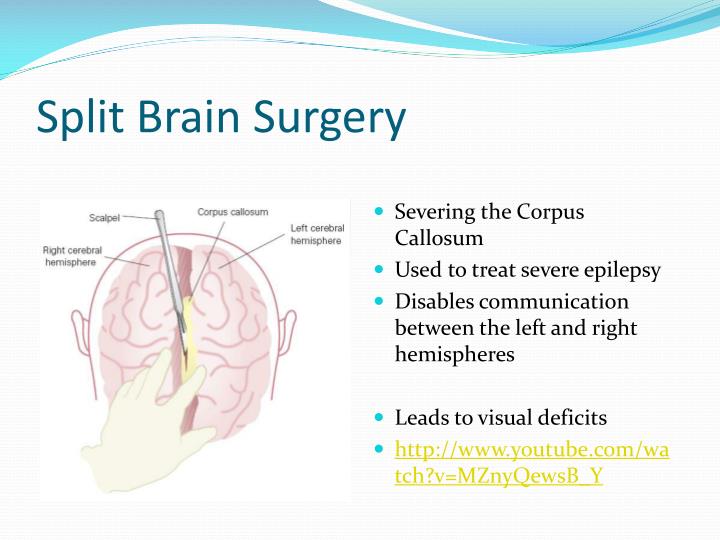 PPT - Brain function – the evidence from brain damage PowerPoint ...