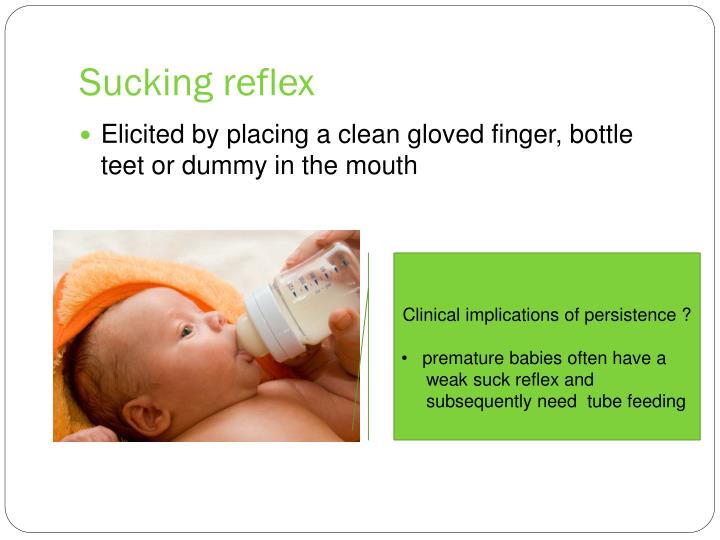 PPT - Primitive Reflexes in the baby PowerPoint Presentation - ID:1926572