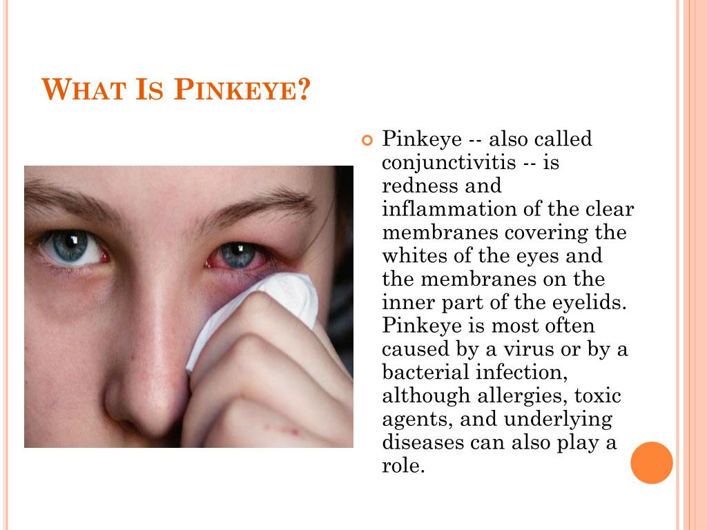 PPT - Pinkeye (Conjunctivitis) Slideshow: Causes, Symptoms, & Treatments PowerPoint Presentation ...