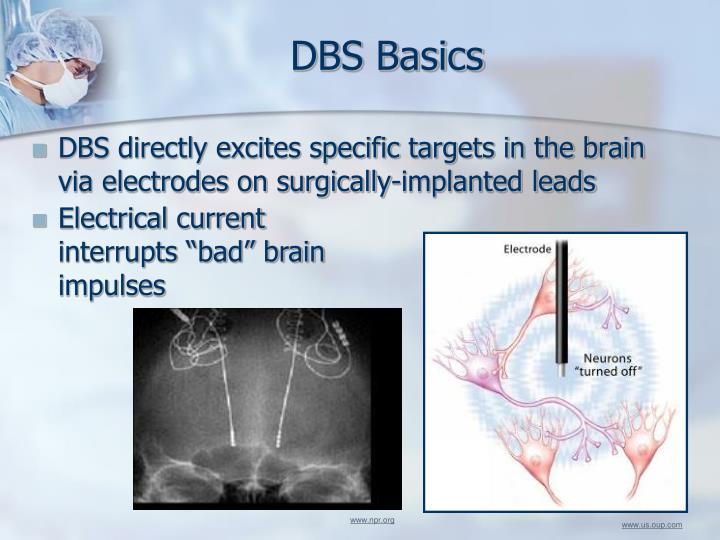 PPT - Deep Brain Stimulation PowerPoint Presentation - ID:1928254