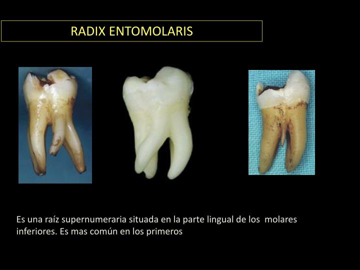 PPT - MOLARES PowerPoint Presentation - ID:1929846