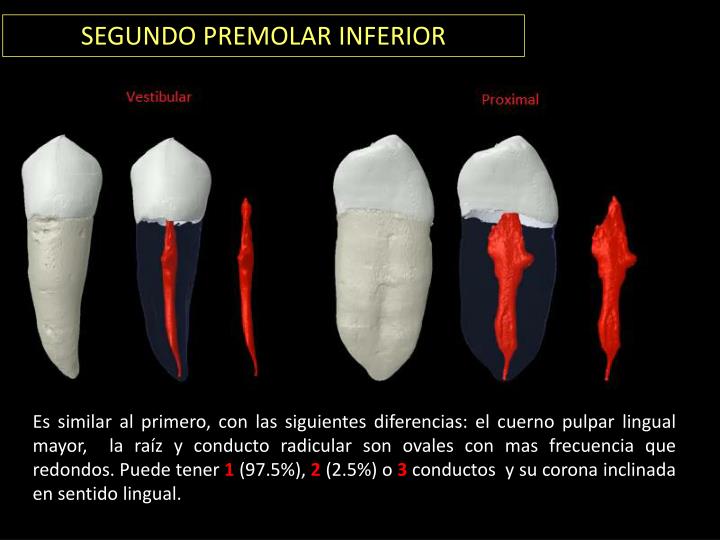 PPT - PREMOLARES PowerPoint Presentation - ID:1929853
