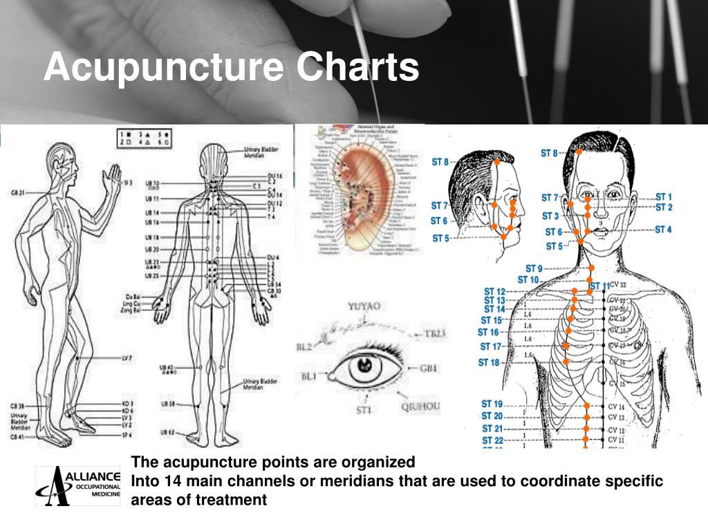 PPT - How Acupuncture Plays a Role in Occupational Medicine PowerPoint ...