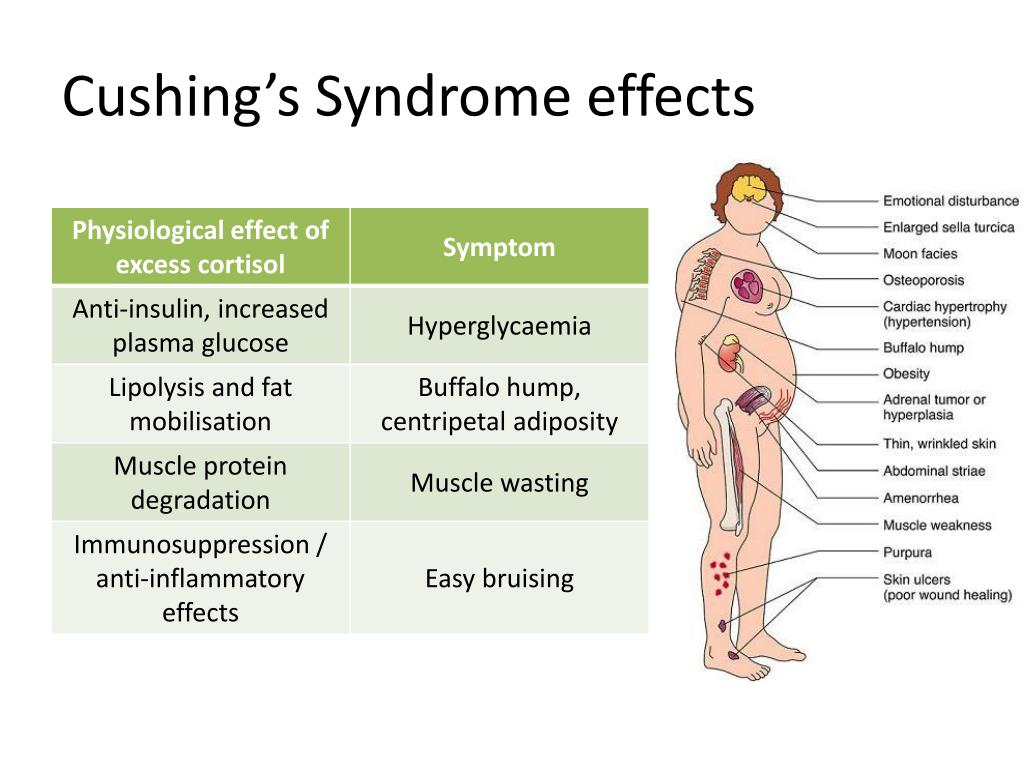 Ppt Adrenal Disease Powerpoint Presentation Free Download Id 1930829
