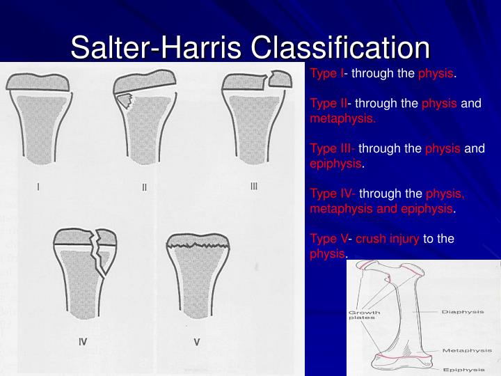 PPT - Diagnostic Imaging Musculoskeletal PowerPoint Presentation - ID ...