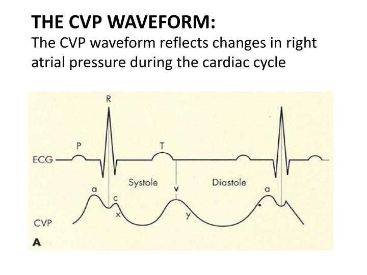 PPT - Central Venous Line (CVL) AND Central Venous Pressure (CVP ...