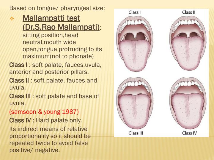 PPT - PRINCIPLES OF AIRWAY ASSESSMENT PowerPoint Presentation - ID:1931696
