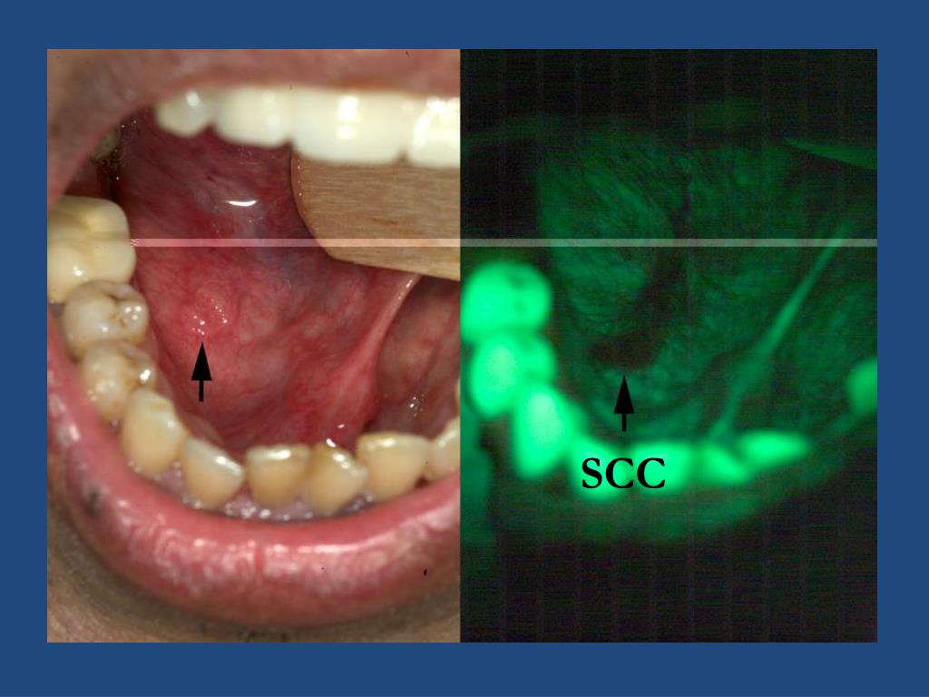PPT - Northern Arizona University Dental Hygiene PowerPoint ...