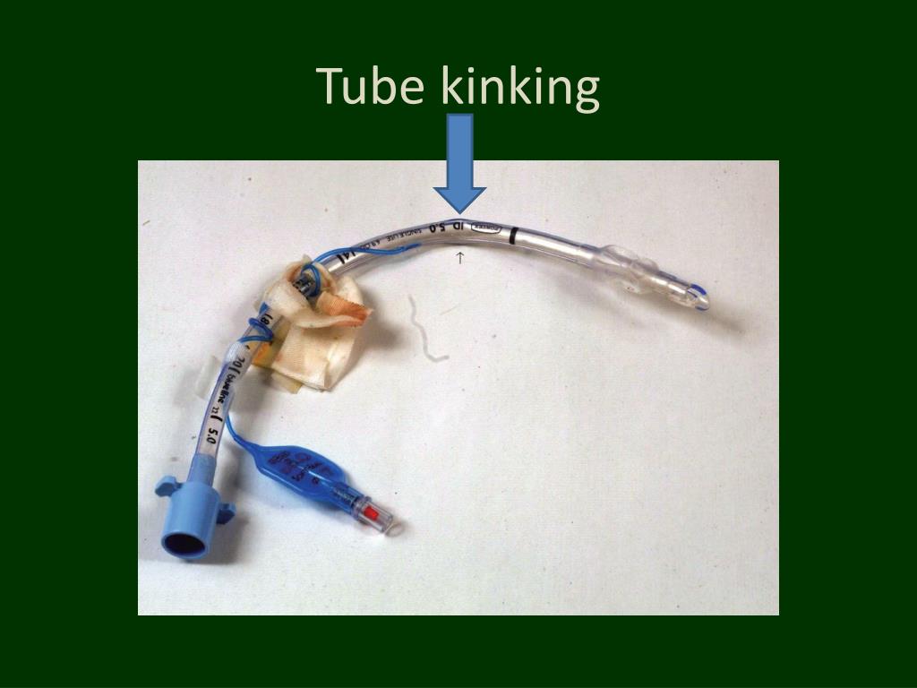 PPT - Anaesthetic considerations in posterior fossa surgery PowerPoint ...