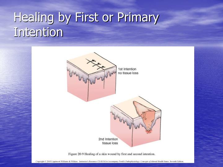 PPT - WOUND HEALING PowerPoint Presentation - ID:1934607