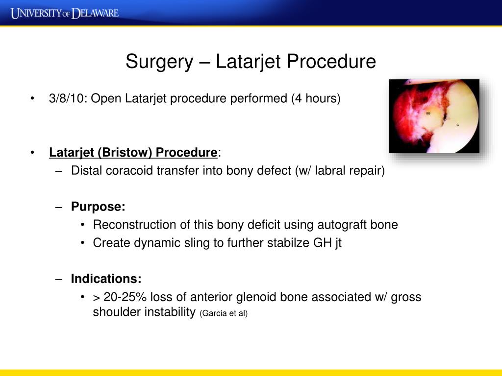 PPT - Chronic Shoulder Instability in X Games Athlete PowerPoint ...