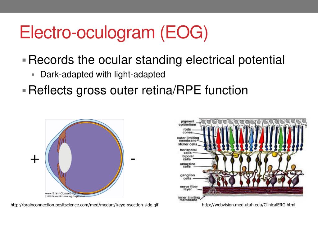 PPT - Clinical electrophysiology: PowerPoint Presentation, free ...