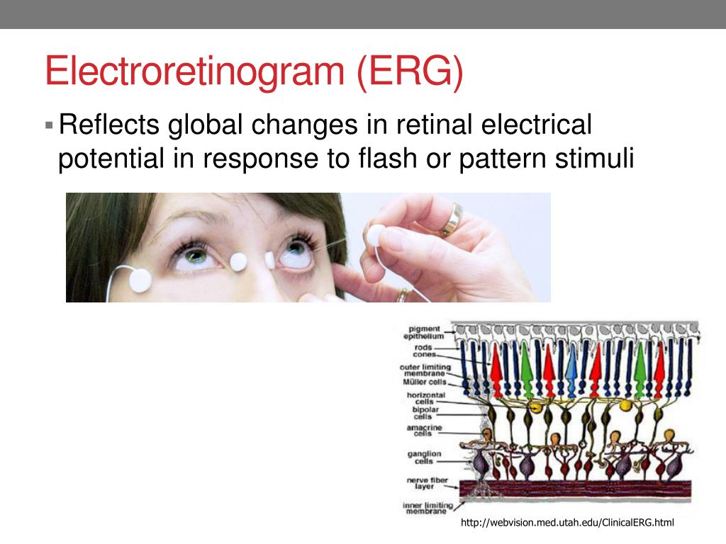 PPT - Clinical electrophysiology: PowerPoint Presentation, free ...