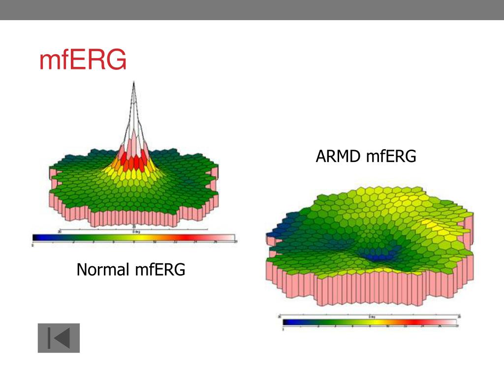 PPT - Clinical electrophysiology: PowerPoint Presentation, free ...