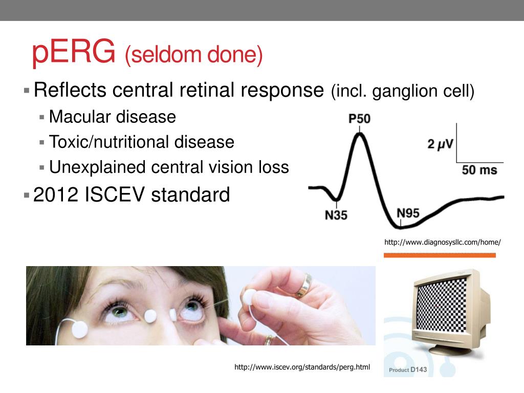 PPT - Clinical electrophysiology: PowerPoint Presentation, free ...