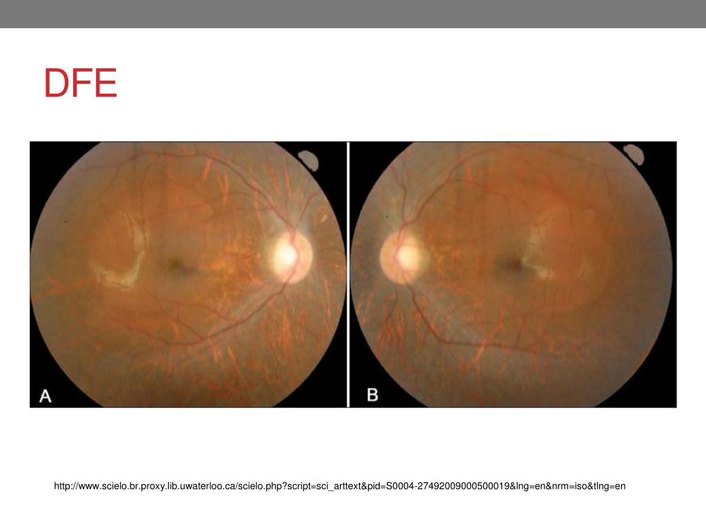 PPT - Clinical electrophysiology: PowerPoint Presentation, free ...