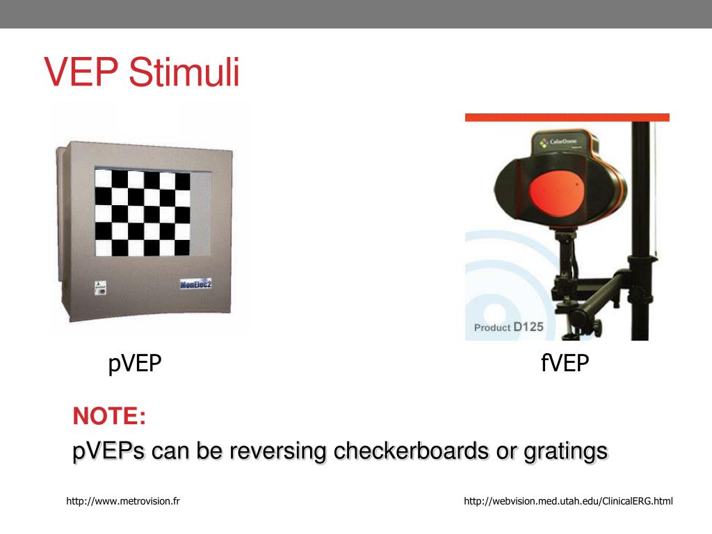 PPT - Clinical electrophysiology: PowerPoint Presentation, free ...