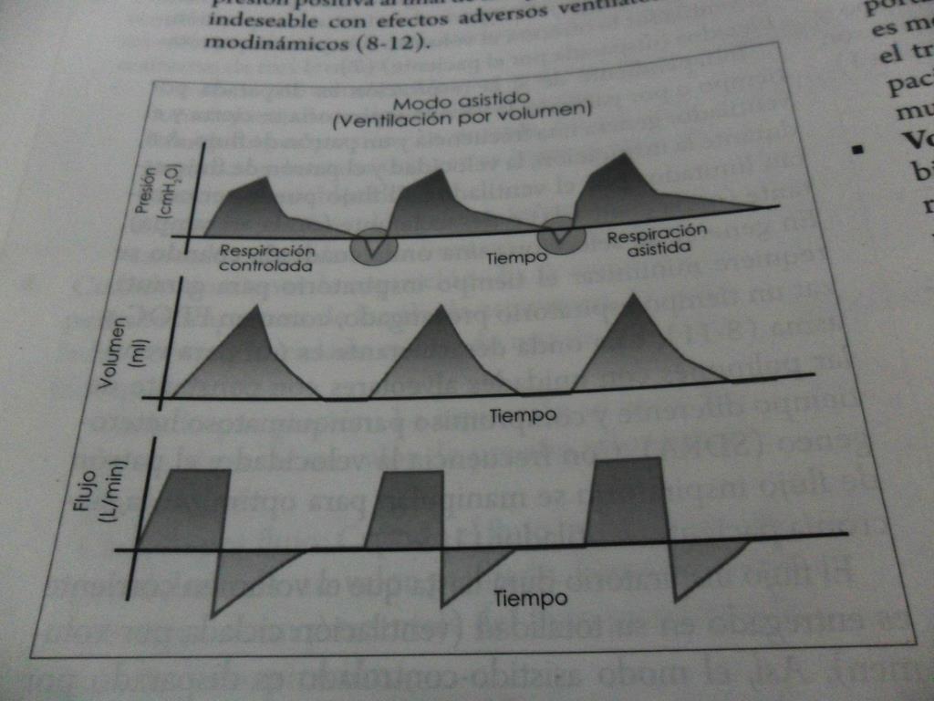 PPT - Modos de Ventilación Mecánica y Monitorizacion PowerPoint ...