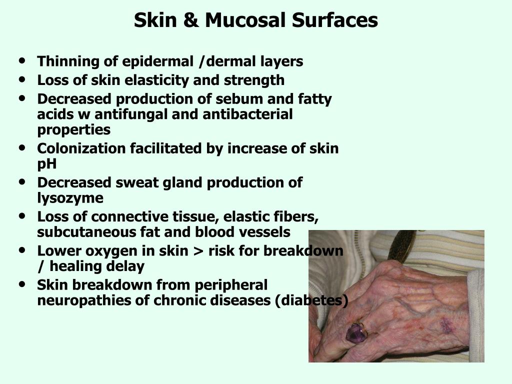 PPT - Elderly Patient: Risk Factors for Infections PowerPoint ...