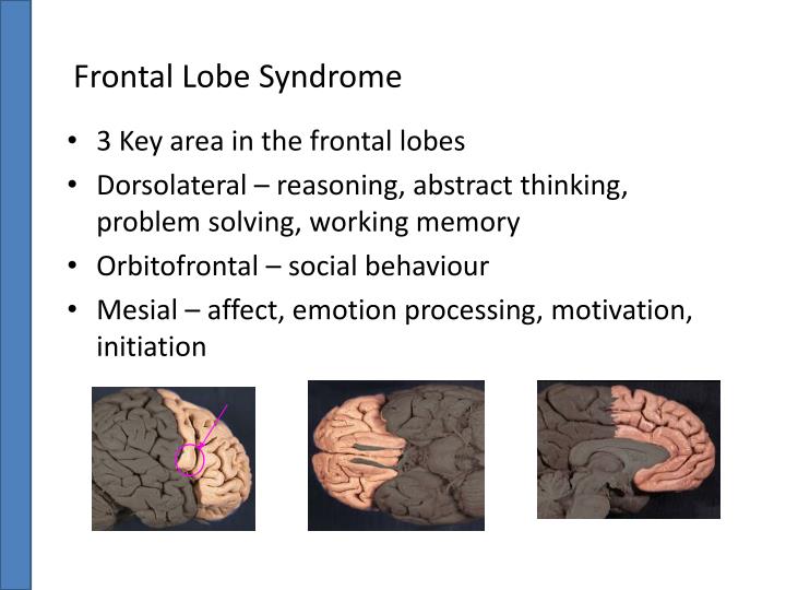 PPT - Cognitive neuropsychology/neurology in theory – functional ...