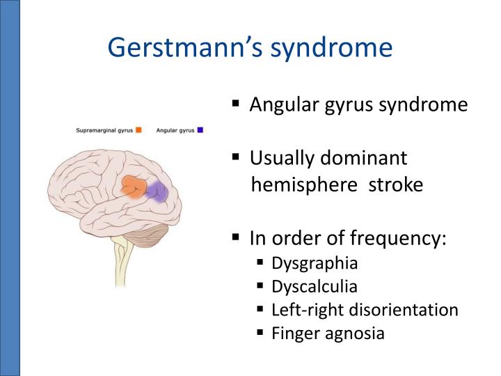 PPT - Cognitive neuropsychology/neurology in theory – functional ...