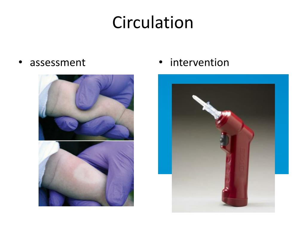 PPT - Pediatric Trauma 2014 Emergency Care Trauma Symposium PowerPoint ...