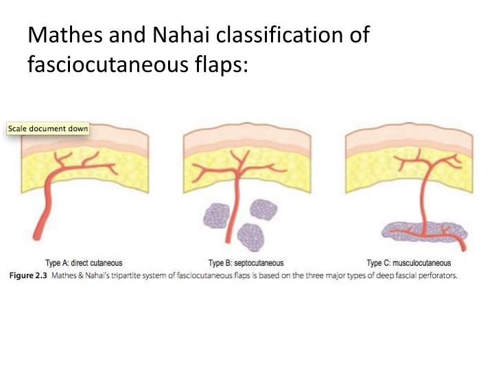 PPT - Scapular, Parascapular and P ectoralis Flaps PowerPoint ...