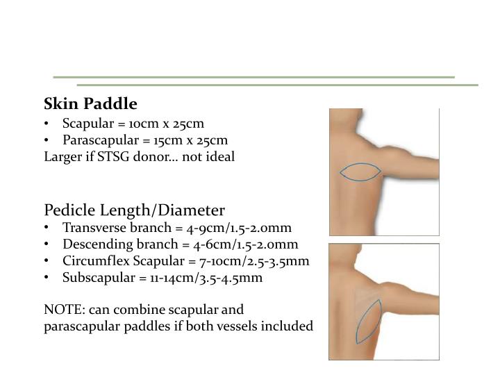 PPT - Scapular, Parascapular and P ectoralis Flaps PowerPoint ...