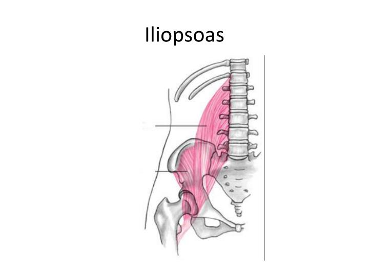 PPT - Iliopsoas PowerPoint Presentation - ID:1939478