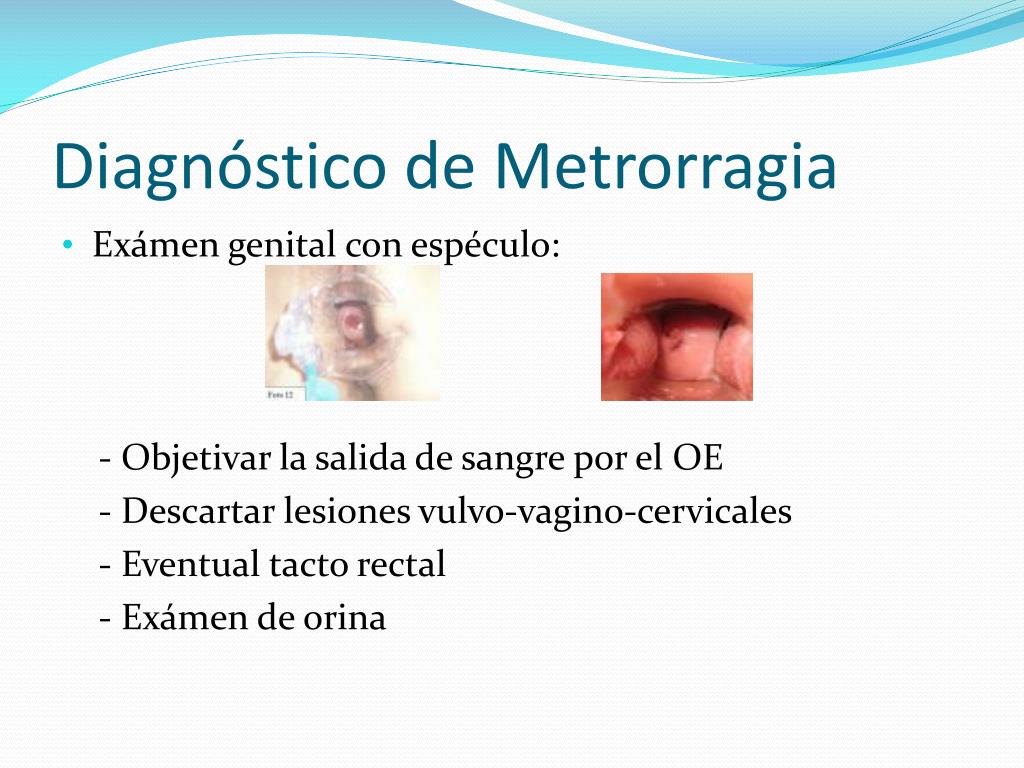 PPT - TRASTORNOS DEL CICLO MENSTRUAL Y METRORRAGIAS NO GRAVIDICAS ...