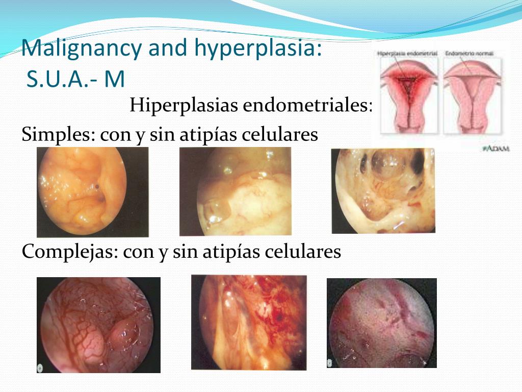 PPT - TRASTORNOS DEL CICLO MENSTRUAL Y METRORRAGIAS NO GRAVIDICAS ...