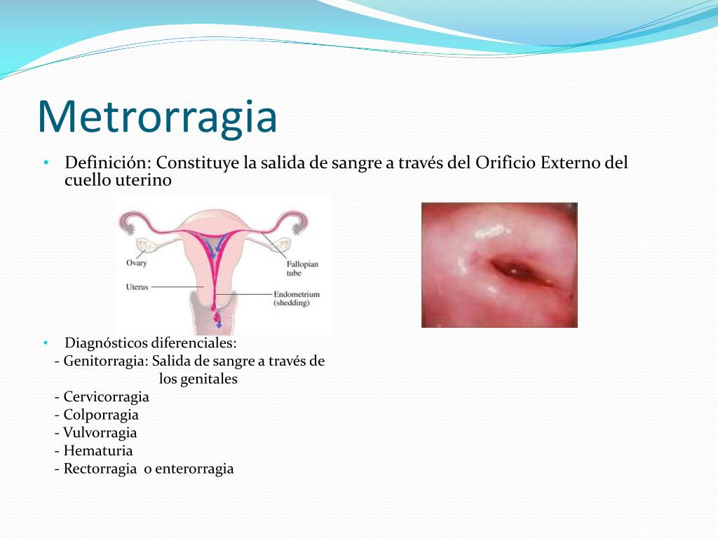 PPT - TRASTORNOS DEL CICLO MENSTRUAL Y METRORRAGIAS NO GRAVIDICAS ...