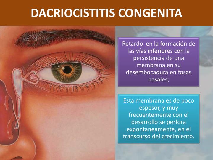 PPT - ENFERMEDADES DEL APARATO LAGRIMAL PowerPoint Presentation - ID ...