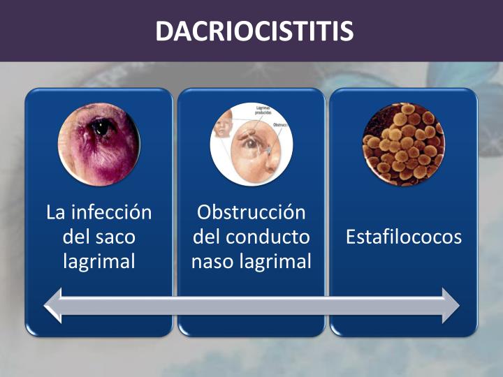 PPT - ENFERMEDADES DEL APARATO LAGRIMAL PowerPoint Presentation - ID ...