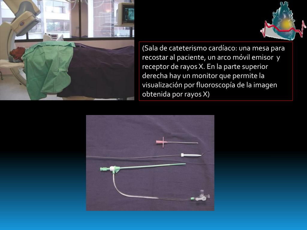 PPT - Cateterismo, Angioplastia y Cirugía Cardiaca Dr . G. Sierra ...