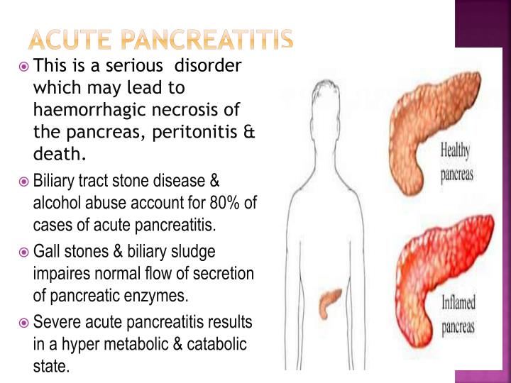 PPT - LIVER DISEASES PowerPoint Presentation - ID:1940263