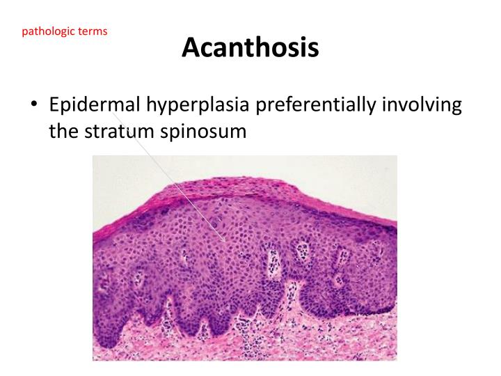 PPT - Skin Pathology PowerPoint Presentation - ID:1942011