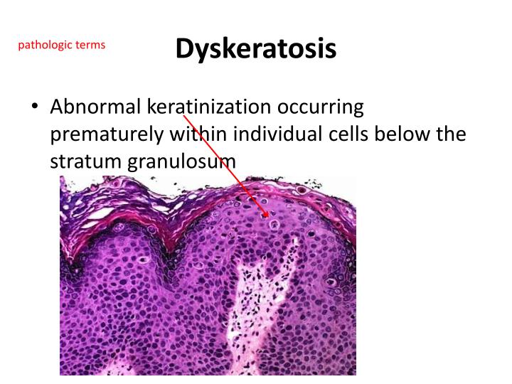 PPT - Skin Pathology PowerPoint Presentation - ID:1942011