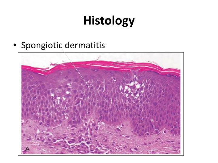 PPT - Skin Pathology PowerPoint Presentation - ID:1942011