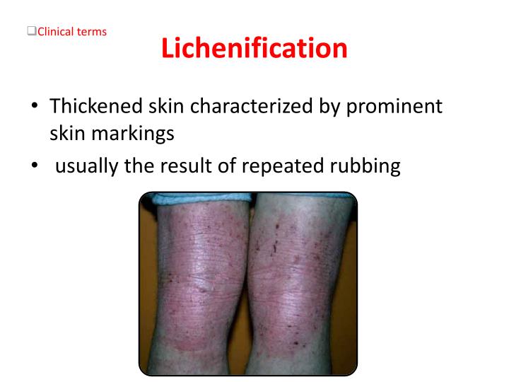 PPT - Skin Pathology PowerPoint Presentation - ID:1942011