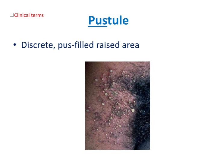 PPT - Skin Pathology PowerPoint Presentation - ID:1942011