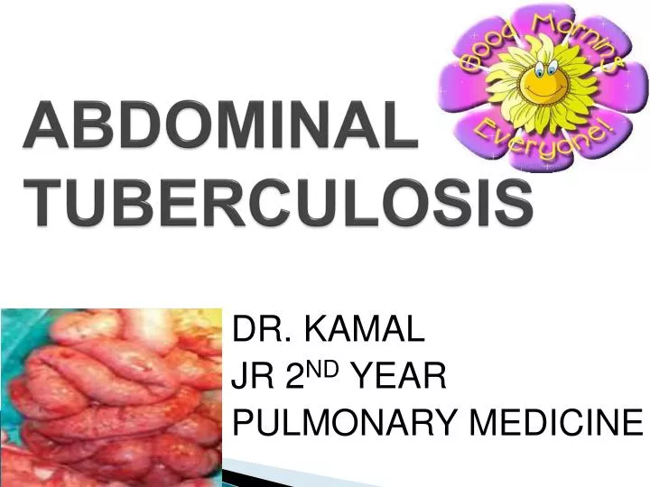 PPT - ABDOMINAL TUBERCULOSIS PowerPoint Presentation, free download - ID:1942061